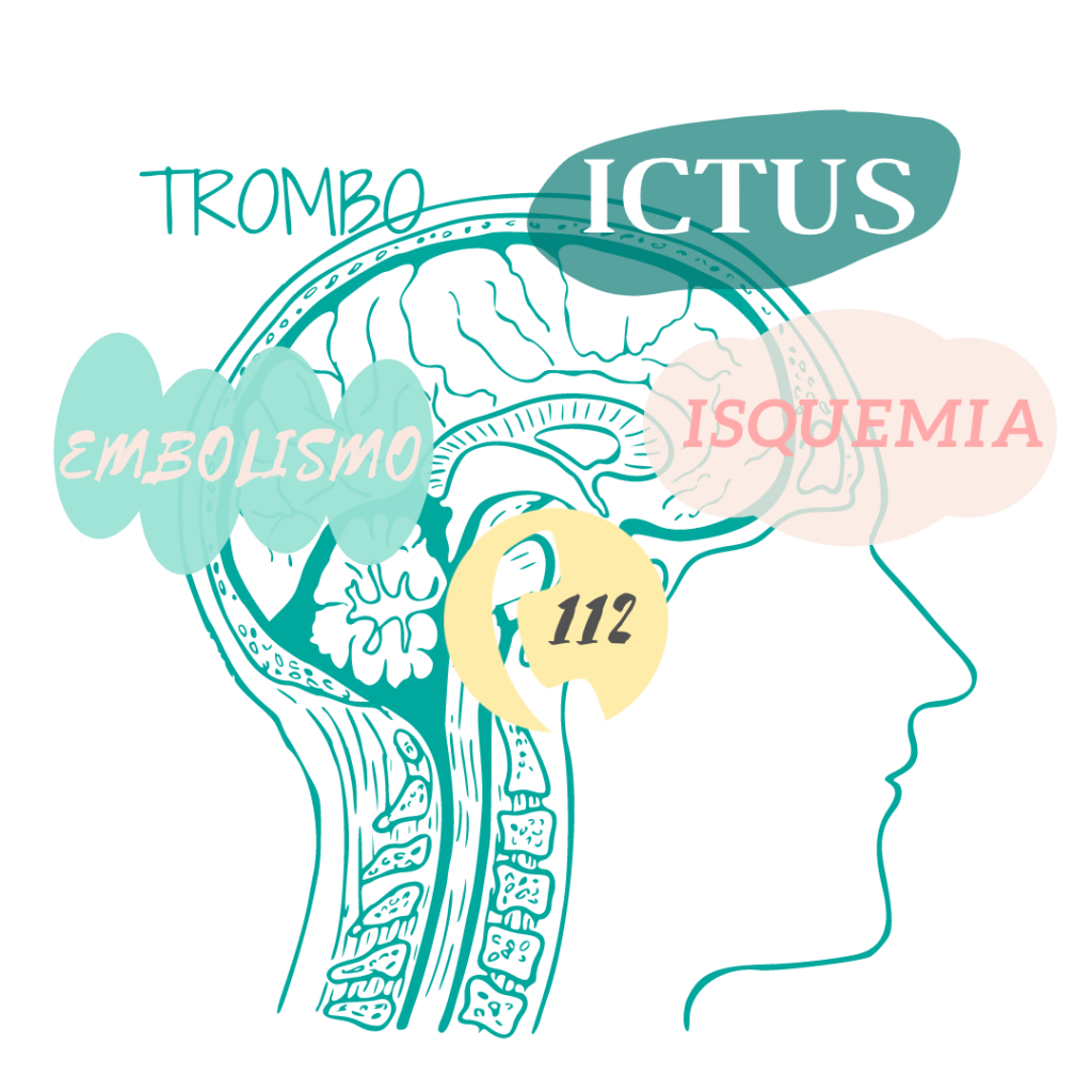 Ictus